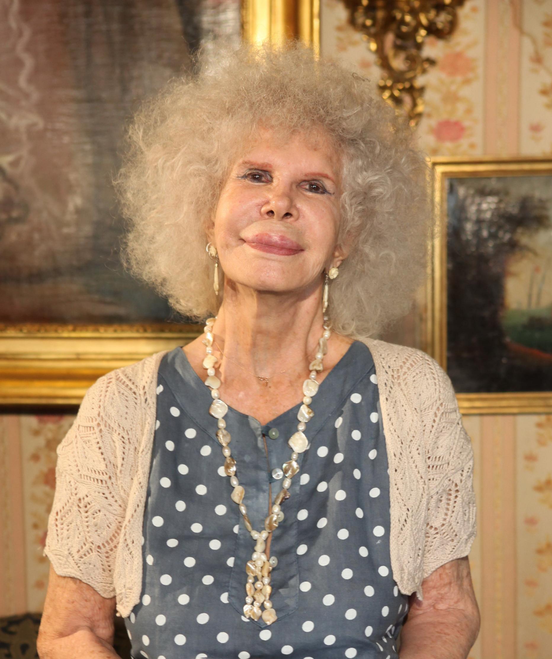 Die Botox-Queens unter den Royals | kurier.at