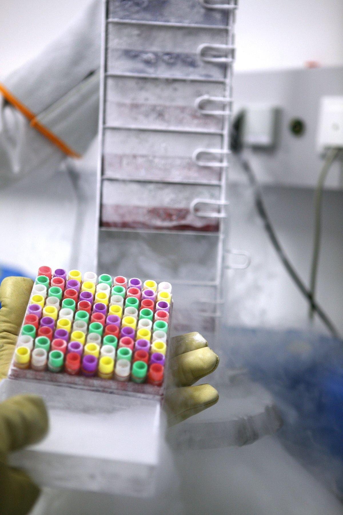 Warum die Biobank Graz die beste Europas ist | Kurier