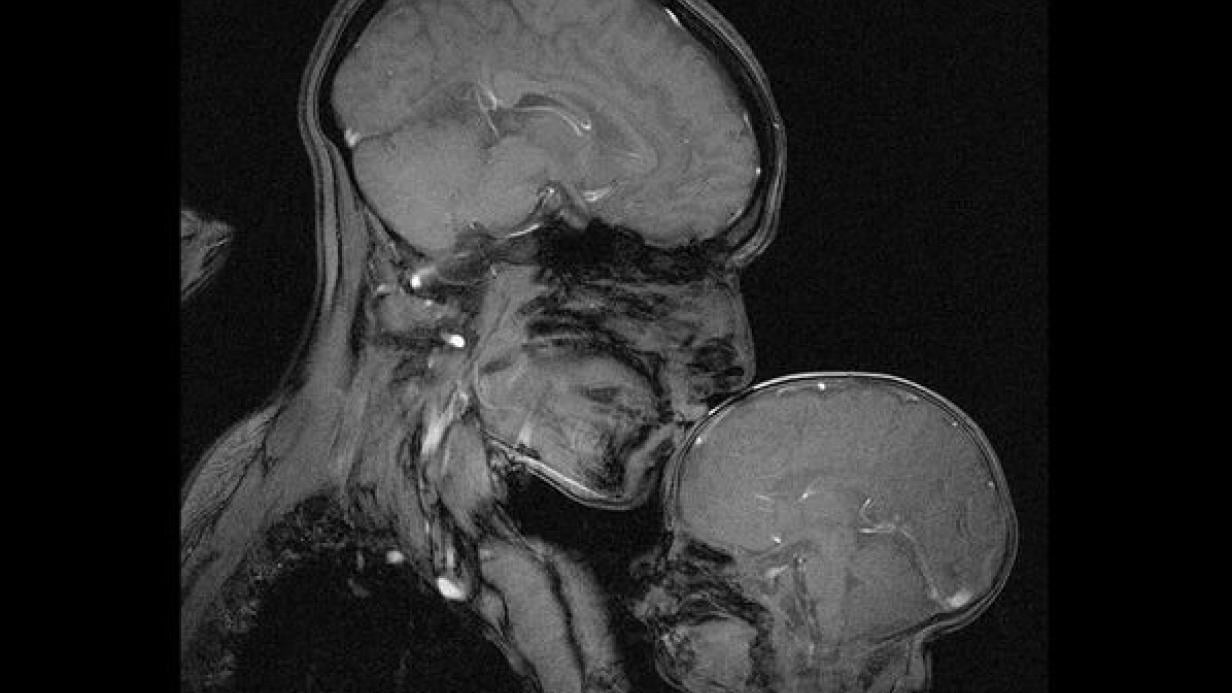 Bewegendes MRT-Bild von Mutter und Baby | Kurier