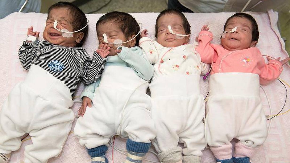Zweimal eineiige Zwillinge: Frau gebar Vierlinge | Kurier