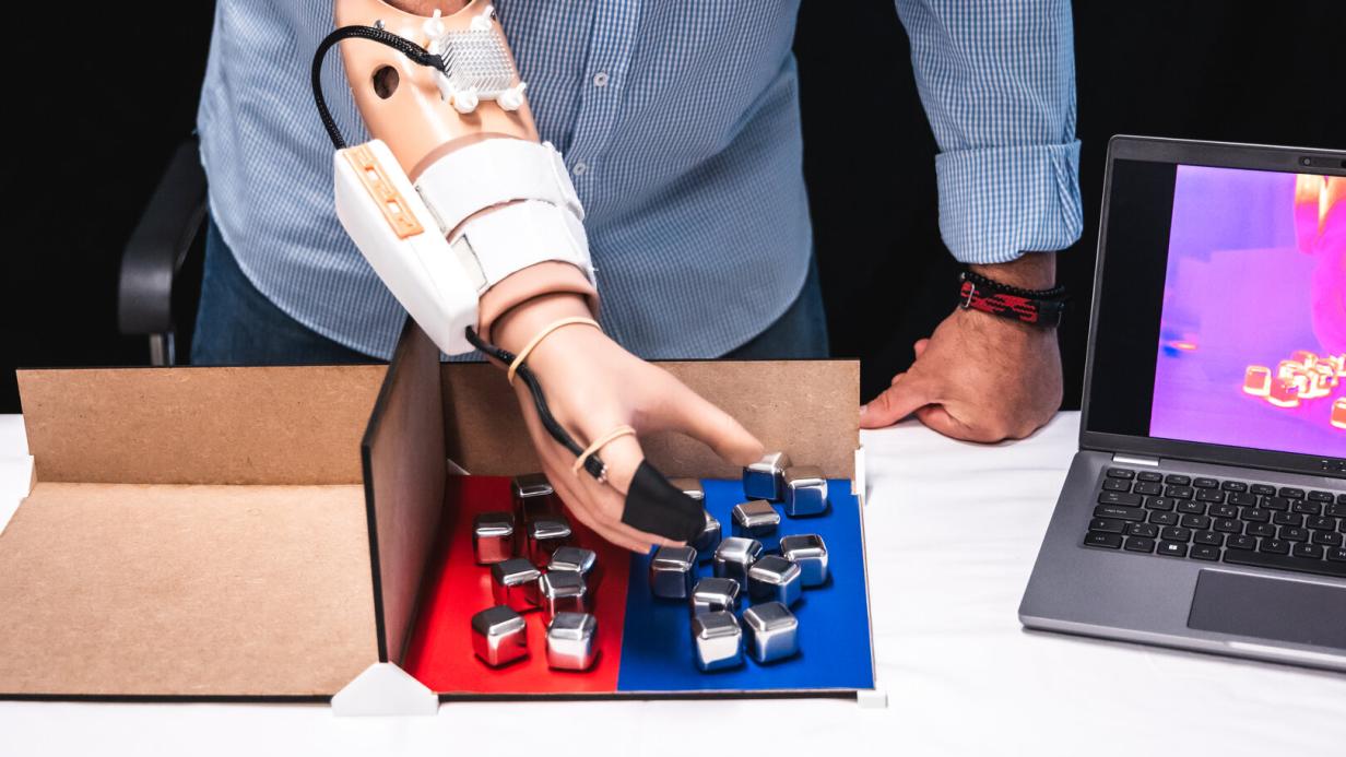 Nach Amputation: Prothese ermöglicht erstmals Empfinden von Wärme | Kurier