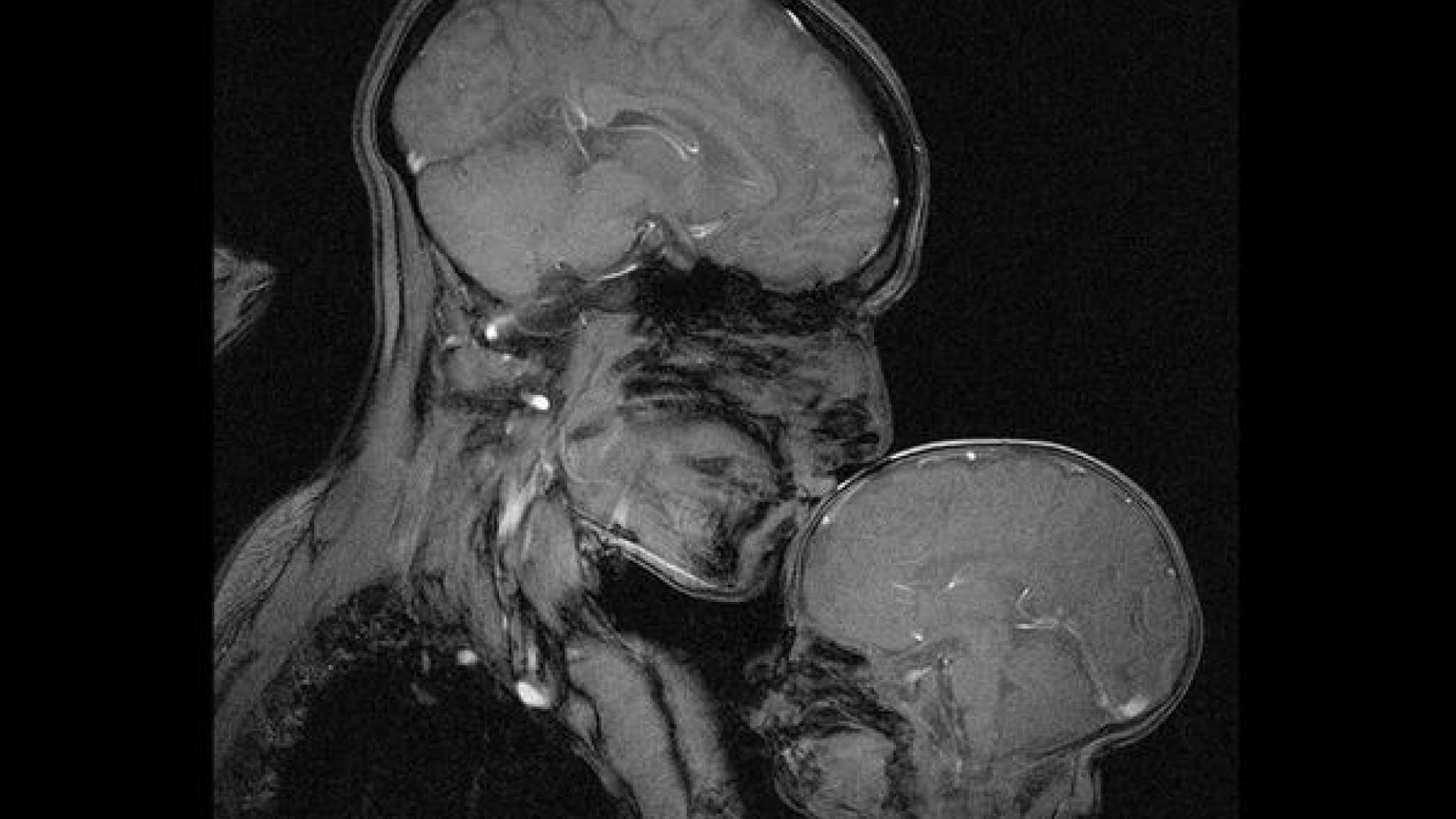 Bewegendes MRT-Bild von Mutter und Baby | Kurier