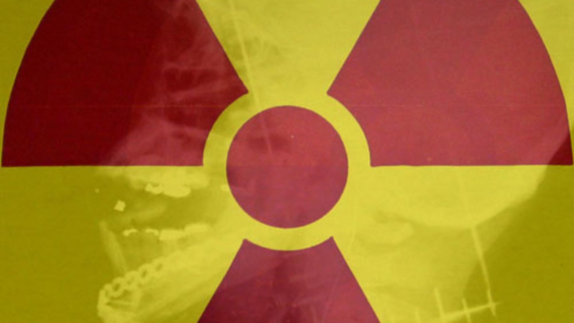 Hilft Radon gegen Rheuma? | Kurier