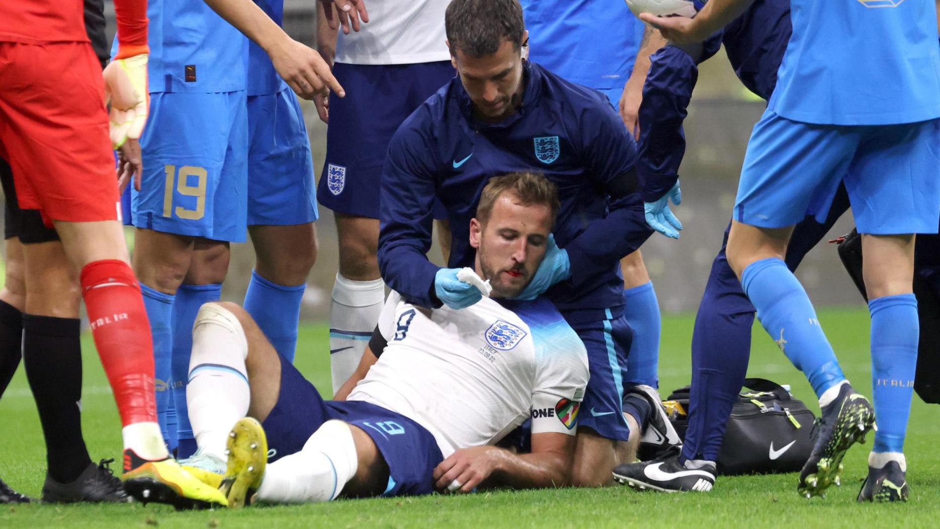 England gegen Deutschland: Ein Fußball-Klassiker mit viel Kopfweh | Kurier