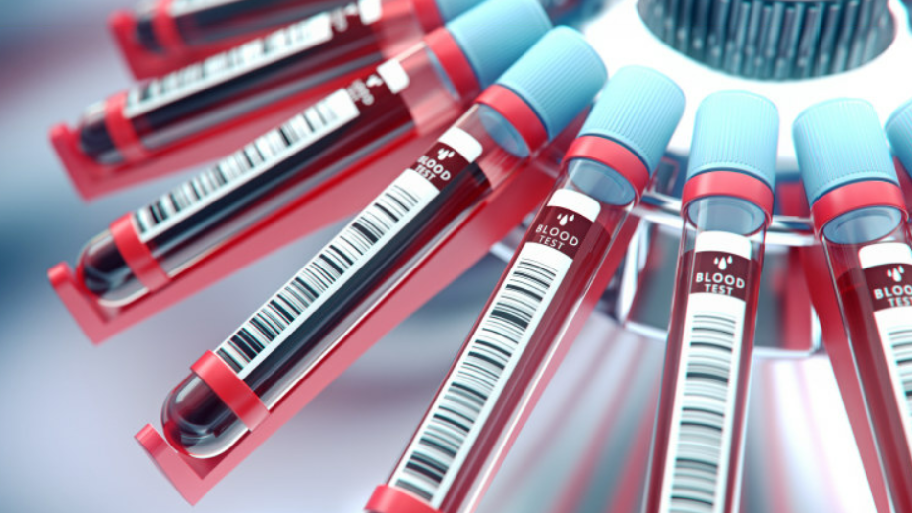 Neuer Bluttest erkennt Bauchspeicheldrüsenkrebs frühzeitig | Kurier