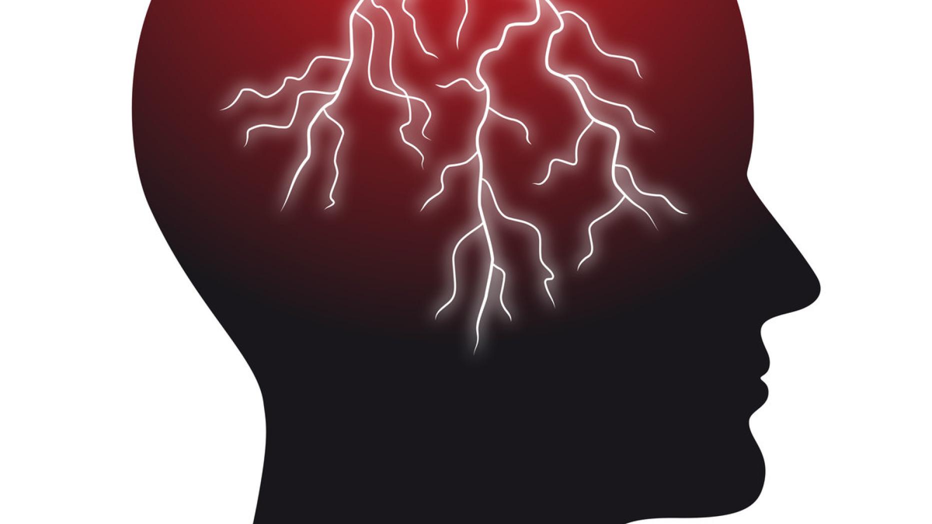 Schizophrenie: Diagnose durch MRT und CT | Kurier