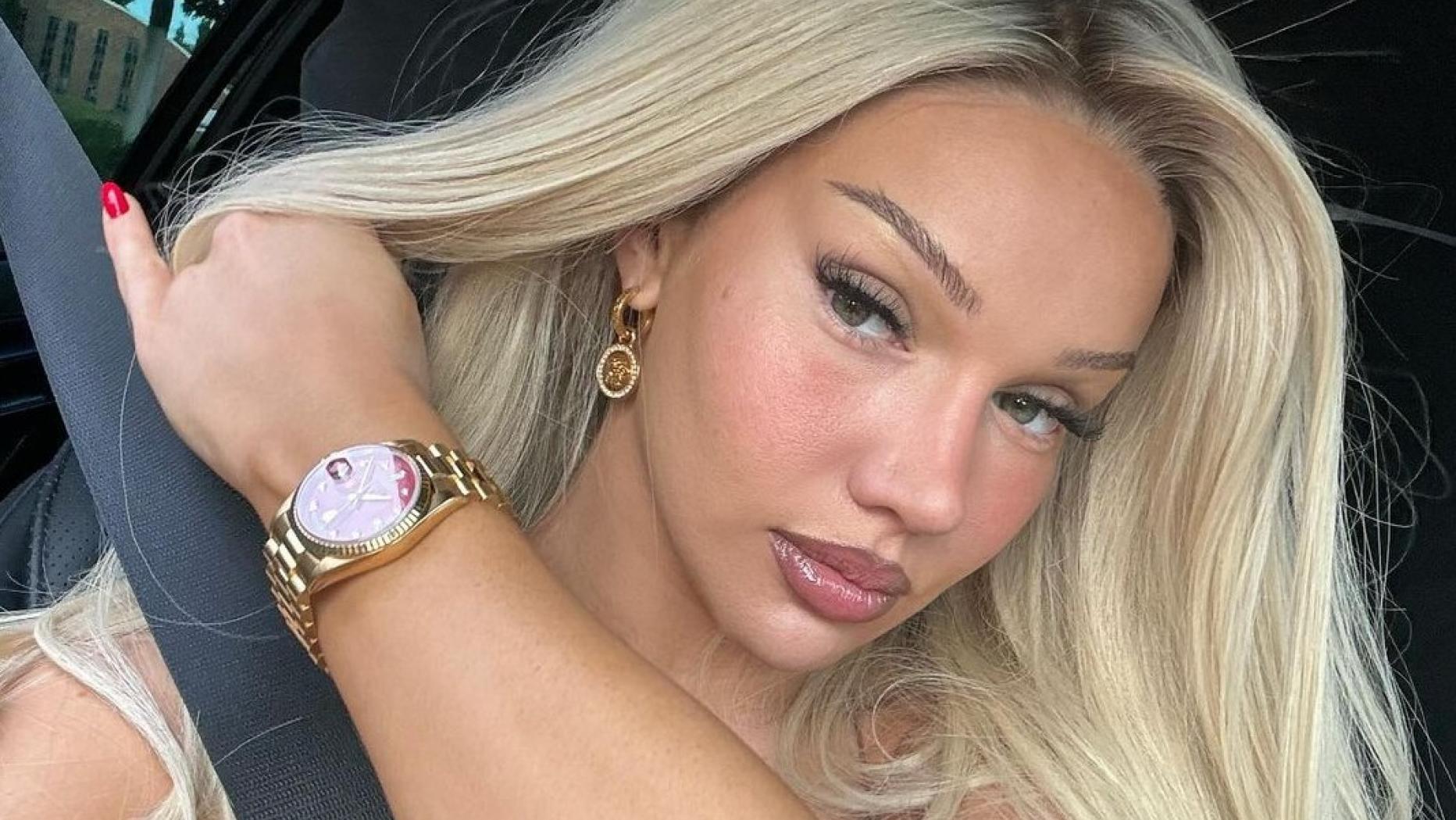 Shirin David: So viele Schönheits-OPs hatte die Rapperin | Kurier