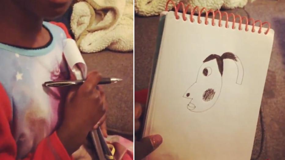 Hyperpigmentation-Meme auf Tiktok: Familie stellt Original-Video nach ...