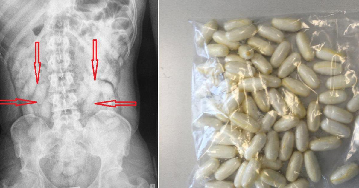 Bodypacker-Prozess: Alle fünf Angeklagten verurteilt | Kurier