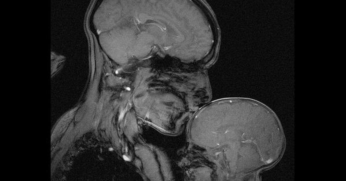 Bewegendes MRT-Bild von Mutter und Baby | Kurier