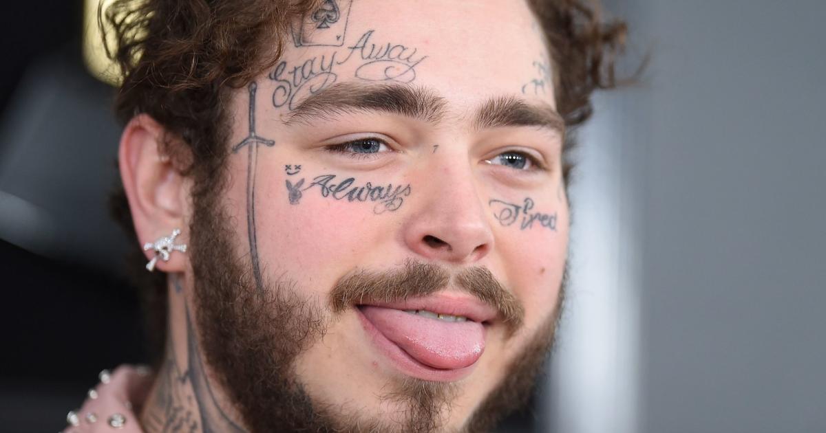 Post Malone hat sich um 1,6 Millionen ein neues Lächeln gegönnt | Kurier
