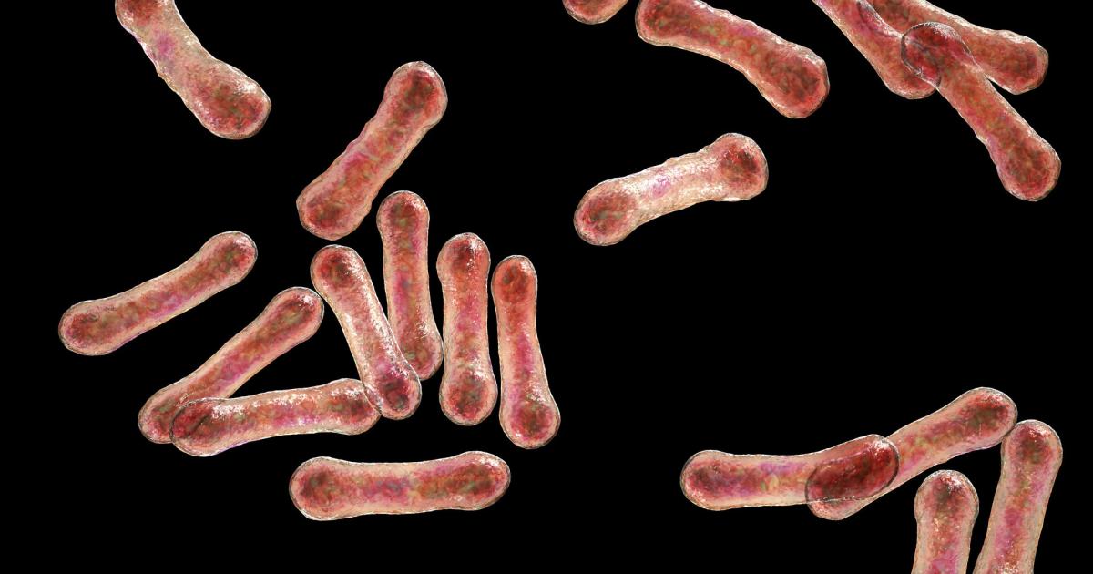 Diphtherie: Zahl der Fälle in Österreich nimmt zu | Kurier