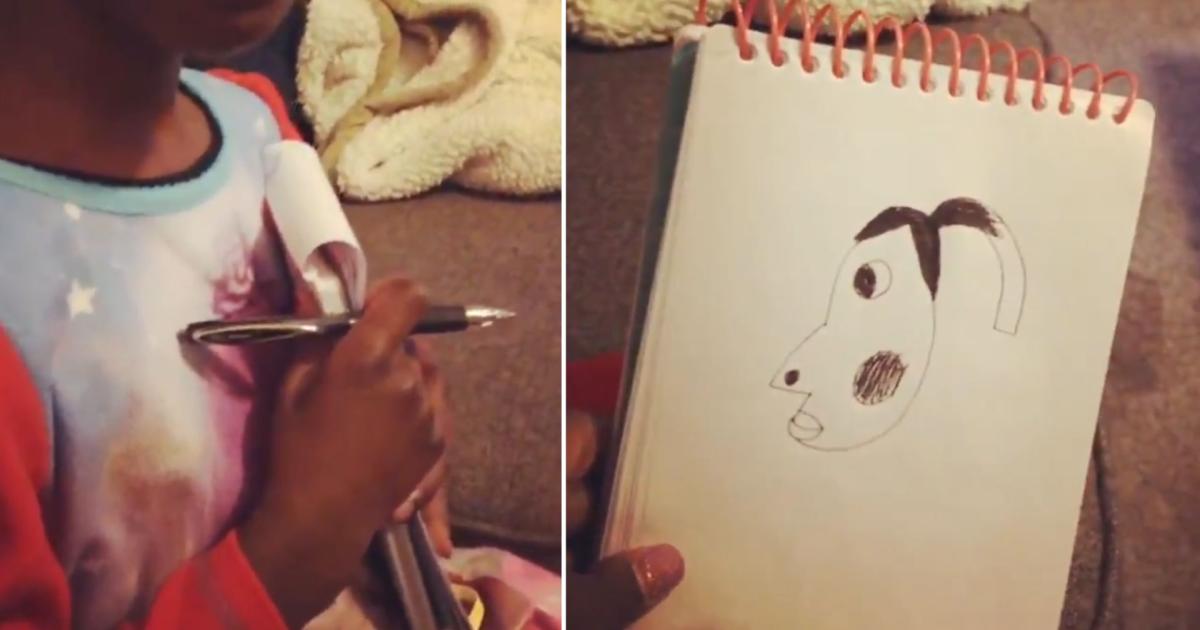 Hyperpigmentation-Meme auf Tiktok: Familie stellt Original-Video nach ...