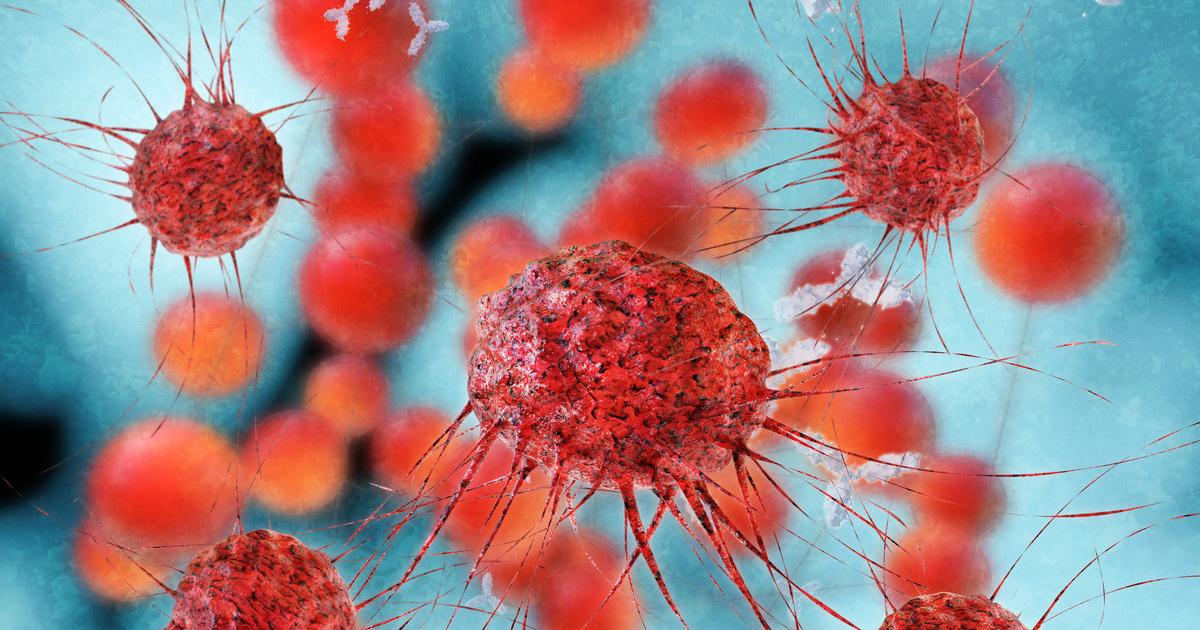 Viele Krebsarten sind einfach "Pech"